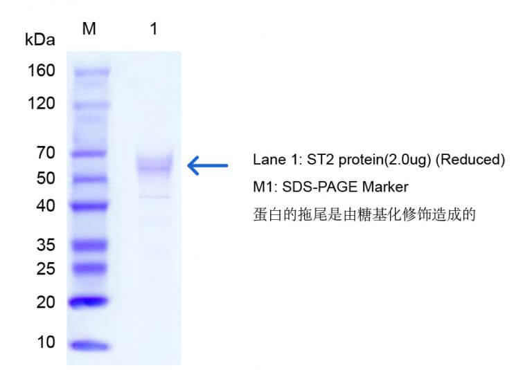 生长刺激表达基因2蛋白-ST2抗原-ST2蛋白免费试用-欧凯生物