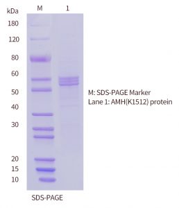 抗缪勒管激素(AMH)抗体抗原--发光大包装试剂-样本符合率>0.95-欧凯生物